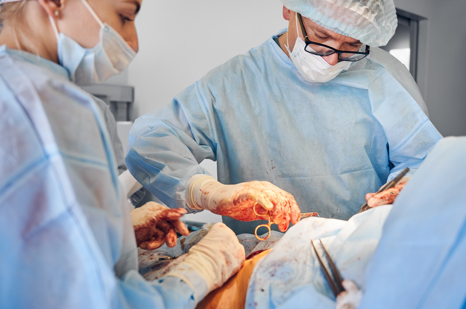 Understanding Appendectomy A Guide To Surgical Removal Of The Appendix