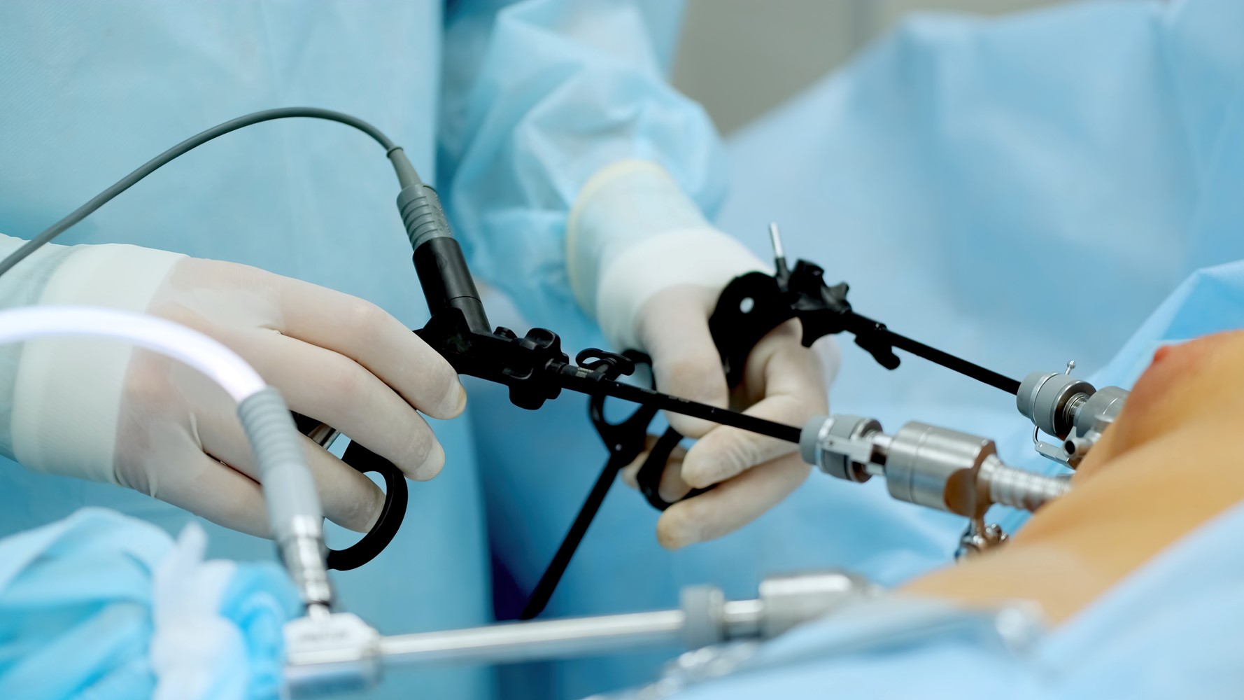 Laparoscopic Hernia Repair: The Modern Solution to a Common Problem ...